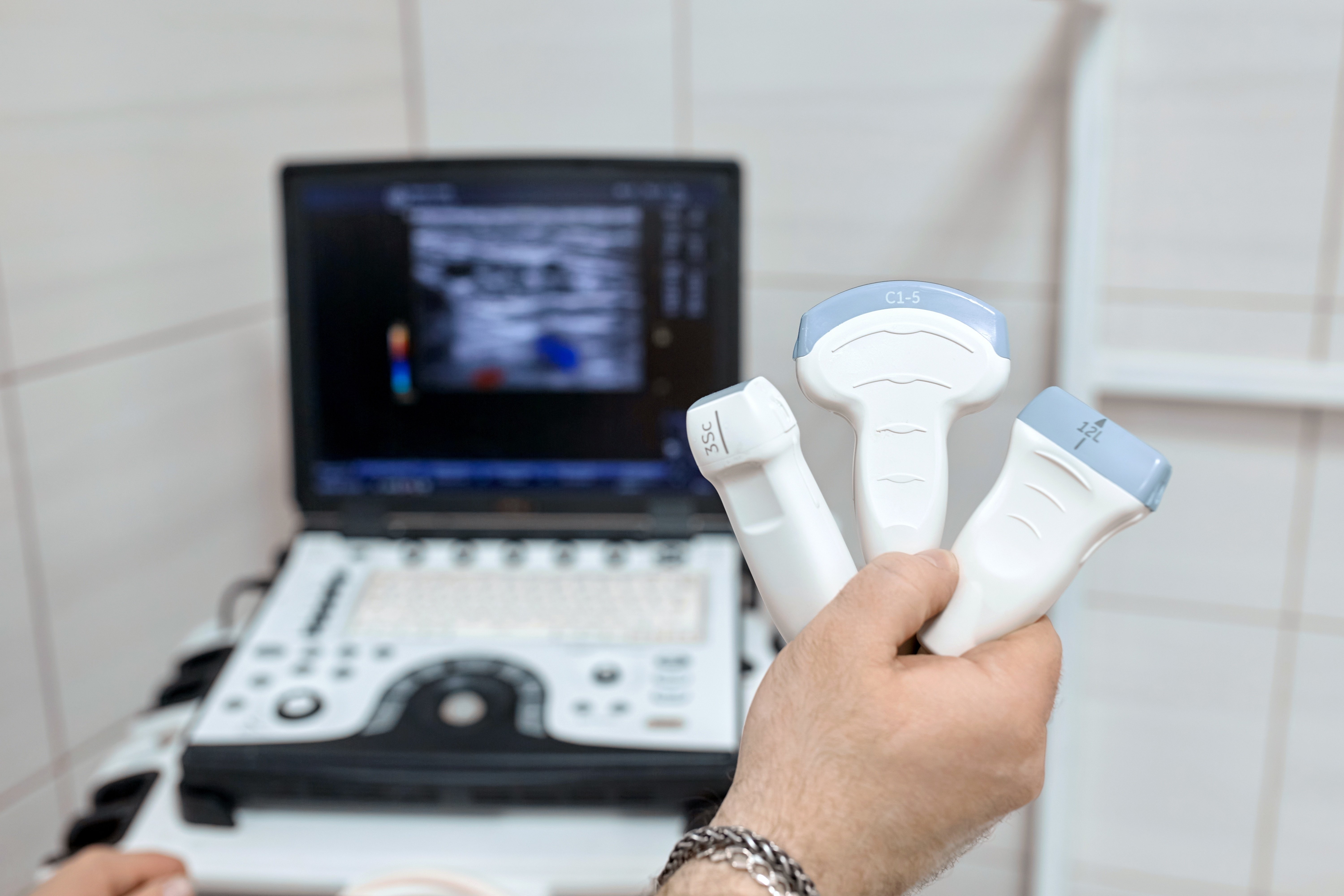 Sonogram vs. Ultrasound: What's the Difference?